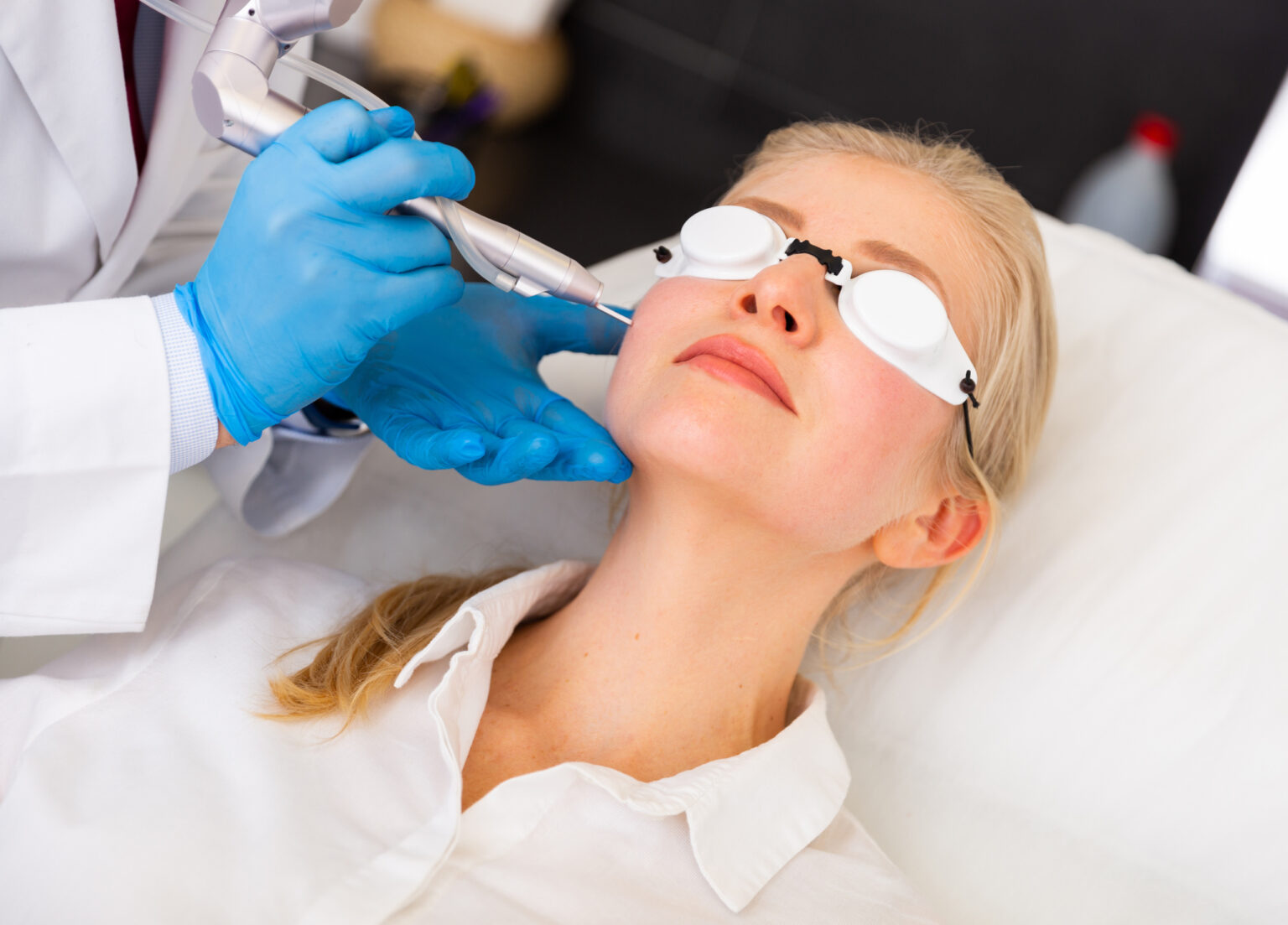 ResurFACE Treatment from Staffordshire Skin & Laser Clinic