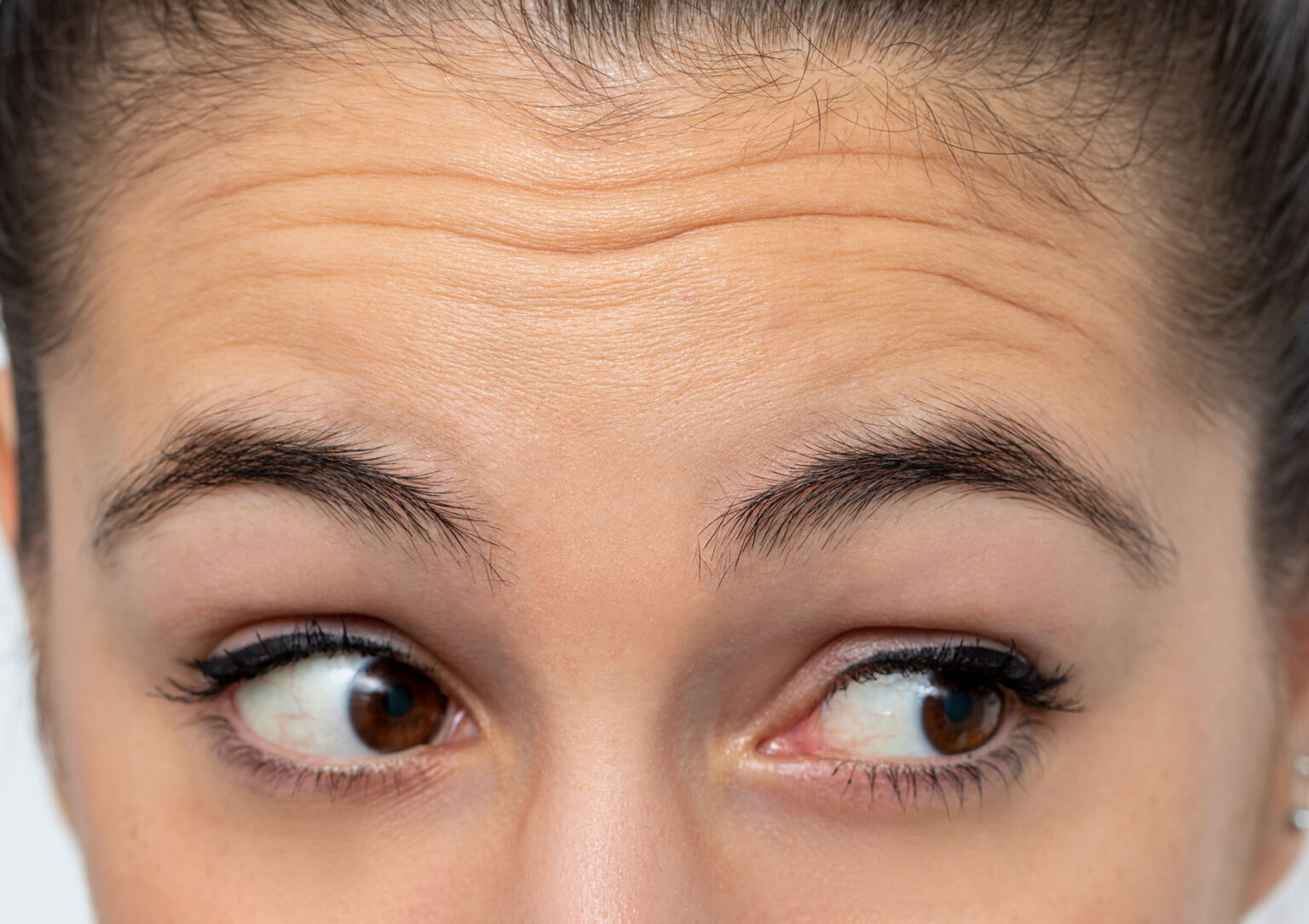 Treating Forehead Lines, Skin Conditions & Skin Concerns